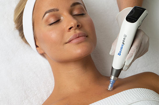 Medical Needling in Essen - health2beauty